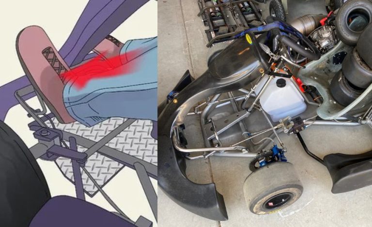 Shifter Kart Transmissions: Top 3 Keys & Best Helpful Guide